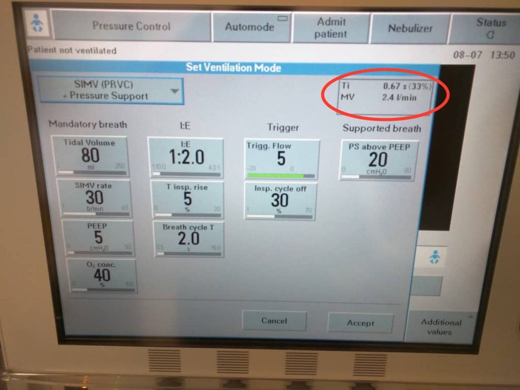 Setting up the Ventilator | Paediatric Emergencies