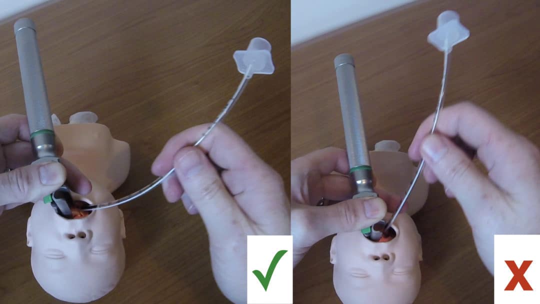 Direct Laryngoscopy | Paediatric Emergencies