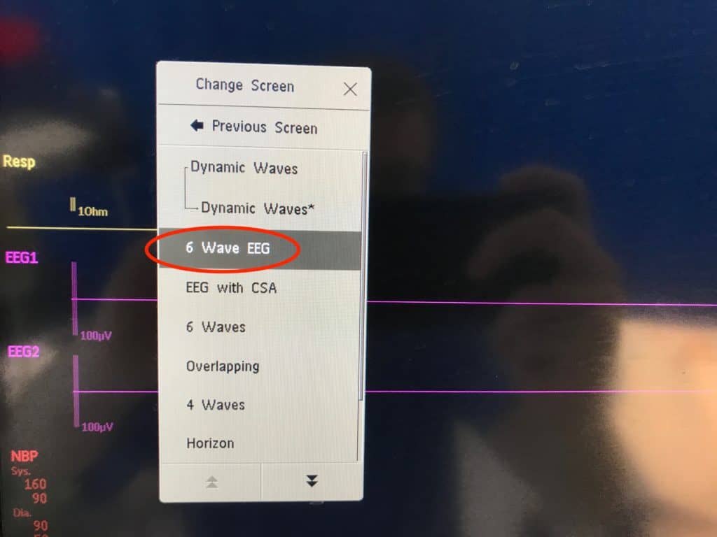 Setting up the Compressed Spectral Array (CSA) | Paediatric Emergencies