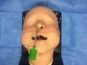 Securing an endotracheal tube | Paediatric Emergencies